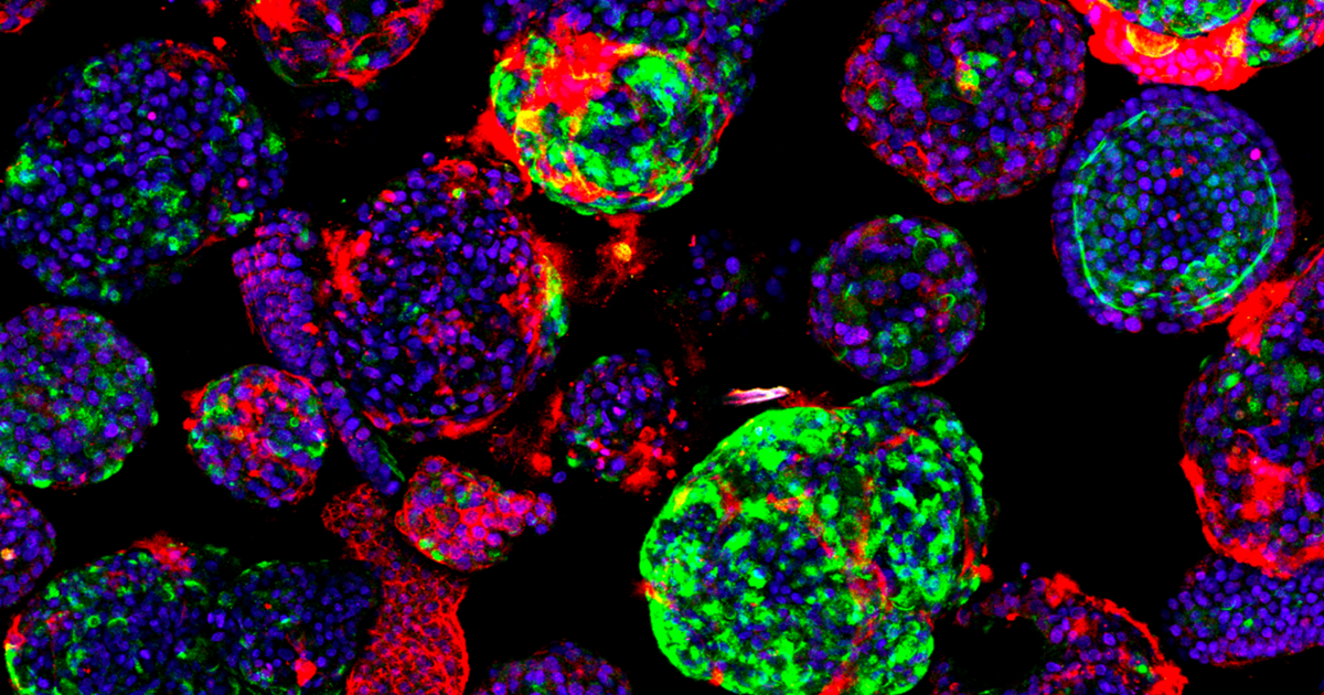 New insights into liver cancer using mini organs